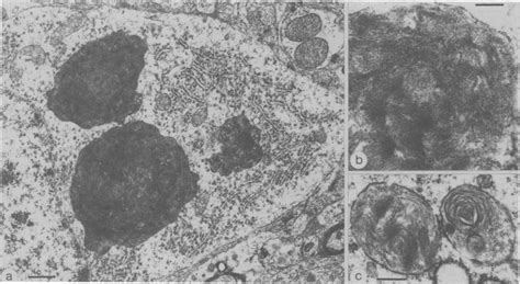 Electronmicrographs Of A Cerebral Cortical Neuron With Three Electron Download Scientific