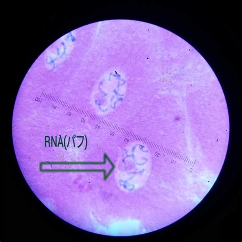 アカムシのだ腺染色体の観察実験 なんとなく実験しています