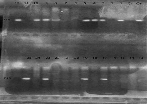Mycoplasma Pcr Genus Electrophoresis Analysis On 1 5 Gel Agarose Lane