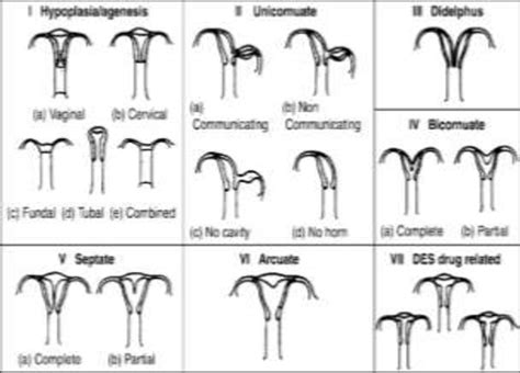 Uterine Abnormalities As Per The Afs American Fertility Society Now