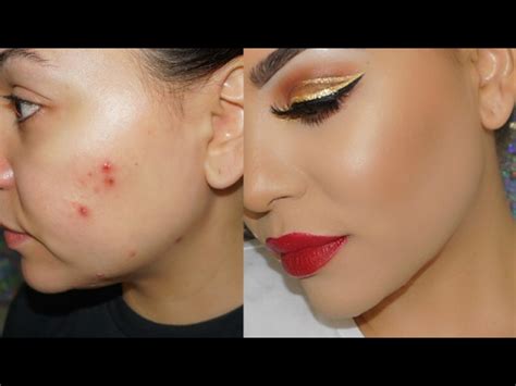 How To Hide A Pimple Scab Without Makeup Saubhaya Makeup