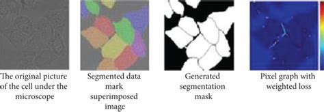 u net network segmentation cell diagram download scientific diagram