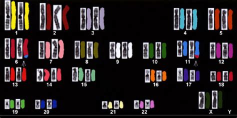 Chromosome Analysis Of The Mother Using Spectral Karyotyping Sky