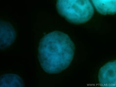 Cdc16 Apc6 Antibody 14307 1 Ap Proteintech