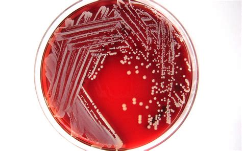 Investigation Sheds Light On The Virulence Of Staphylococcus