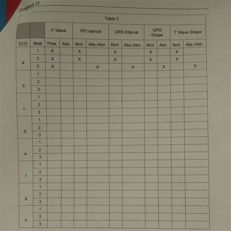 Solved Analyzing The Heart With Ekg Health Care