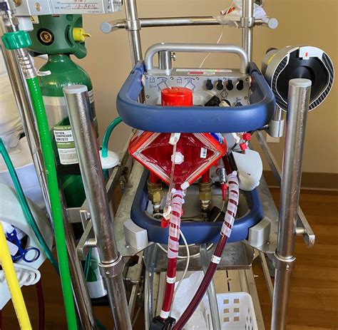 Portable Ecmo Machine