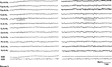 Figure 1 From Frontal Midline Theta Rhythm In Young Healthy Adults Semantic Scholar
