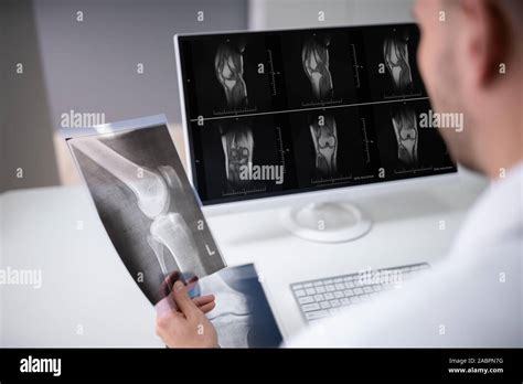 Mri Knee Hi Res Stock Photography And Images Alamy
