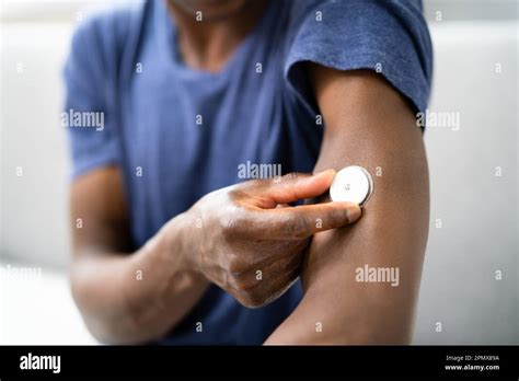 Close Up Of A Man Testing Glucose Level With A Continuous Glucose Monitor On His Arm Stock Photo