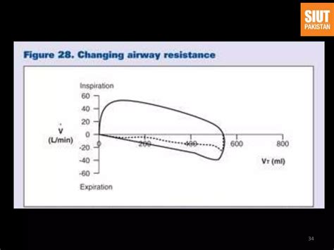 Ventilator Waveforms Ppt