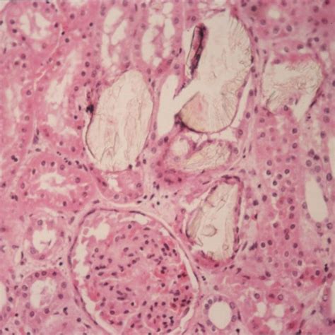 14 Bronchus Associated Lymphoid Tissue Of A Platypus Displaying An