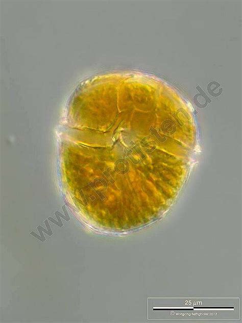 Peridinium Microscope
