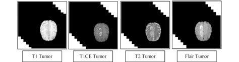 Sample Mri Scans To Represent The Multiclass Brain Tumor Classification