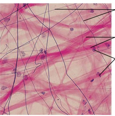 Connective Tissue Flashcards Quizlet