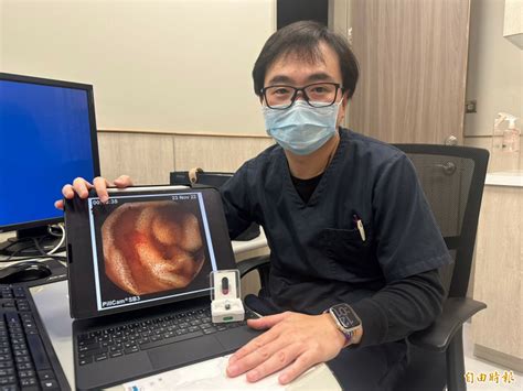 膠囊內視鏡檢查立大功 免侵入揪出小腸出血點 自由健康網