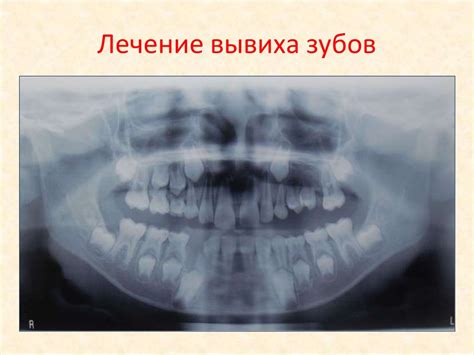 Травма зубов у детей - презентация онлайн