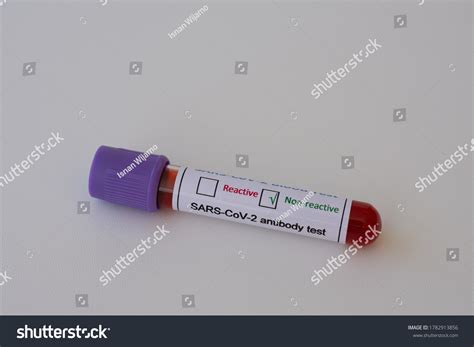 382 Imágenes De Non Reactive Imágenes Fotos Y Vectores De Stock Shutterstock