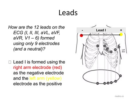 Simple Ecg Learningmempptx