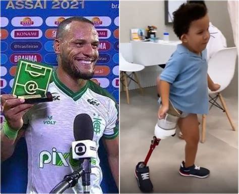 Em Vitória Do América Mg Patric Dedica Gol Ao Filho Que Luta Contra