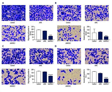 Down Regulation Of Nfatc1 Suppressed Migration And Invasion Of Pca