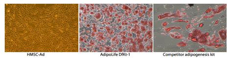 Adipogenic Differentiation Medium For Stem Cells