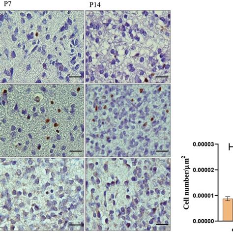 Immunoreactivity Of The Apoptotic Cells In The Sc At P0 P7 And P14 In