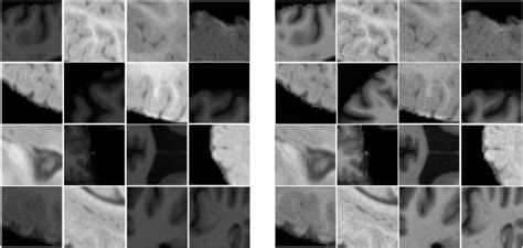 Figure From Adversarial Normalization For Multi Domain Image Segmentation Semantic Scholar