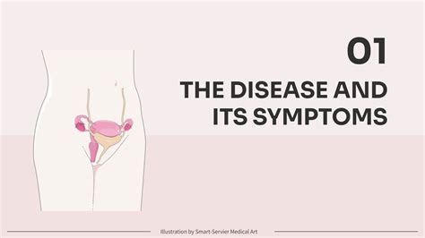 Ectopic Pregnancy Signs And Symptoms Presentation