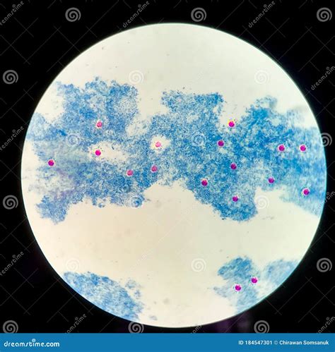 Red Cell On Blue Background Cryptococcus In Hiv Patients Stock Image Image Of Moulds Budding