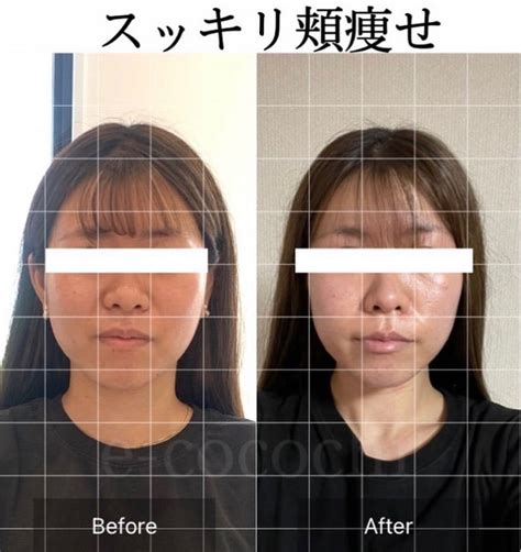 お客様のビフォーアフターのご紹介です♪ 滋賀県守山市【小顔とヘッドスパのお店 イーココチ】