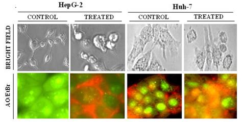 Light And Fluorescence Microscopic Images Of SEBB Treated HepG 2 And