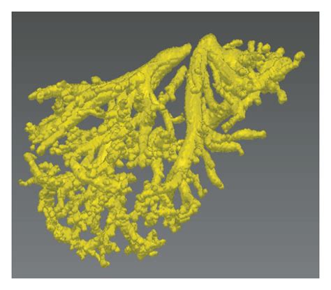 Comparison Of The Improved Fuzzy Connectedness Fc Method With