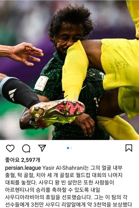사우디 부상 선수 근황 국내축구 에펨코리아