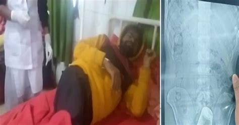 Omg दामाद को ससुराल जाना पड़ा महंगा साले ने प्राइवेट पार्ट में डाल