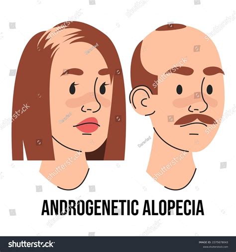 Alopecia Result Over 235 Royalty Free Licensable Stock Illustrations