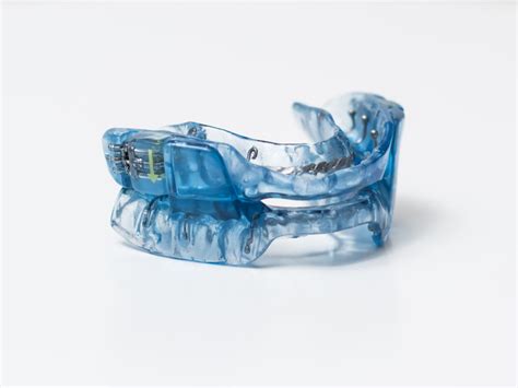 Mandibular Splints For Sleep Apnoea In Nsw And Qld