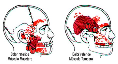 Trastornos Temporomandibulares Clínica Baldor