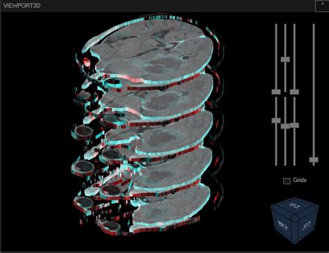 Cranial Ct Rgb 3d Representation With Slice Spacing Download