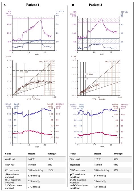 Cardiopulmonary Exercise Testing Of A Patient With No Limitation A Download Scientific