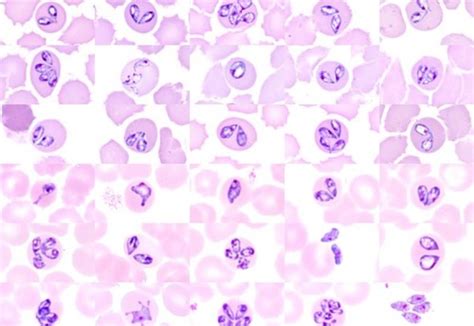 Parasitology Flashcards Quizlet