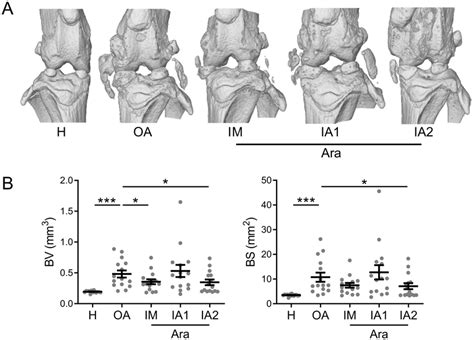 Ara 3000 Beta Protected Knee Joint Soft Tissues From Oa Associated