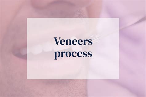 Trident Smiles Dental Veneers Process Step By Step Guide To The