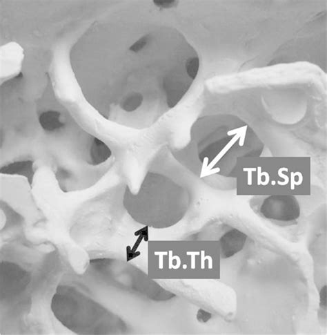 Trabecular Microstructural Parameters Were Measured Using Download