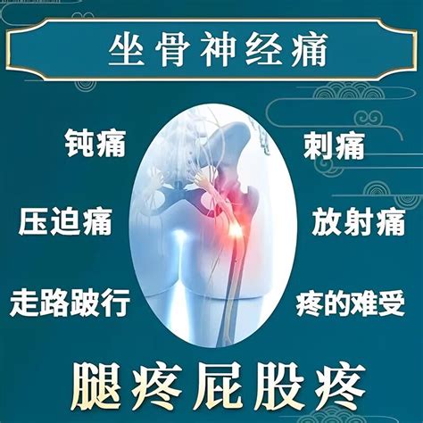 坐骨神经痛专用药腰间盘突出压迫坐骨神经引起的腰疼腿疼屁股疼大小腿麻木抽筋放射性疼痛舒筋活络丸一盒【坐骨神经痛腿疼屁股疼】虎窝购