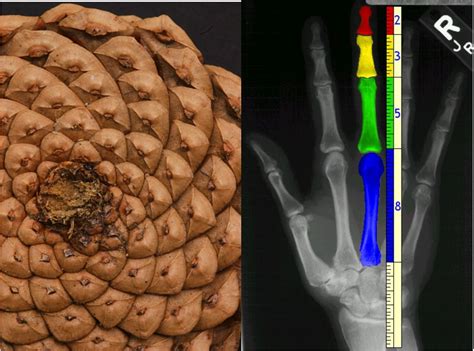 And 12 A Pinecone With Fibonacci Spiral And Fibonacci Numbers On Human