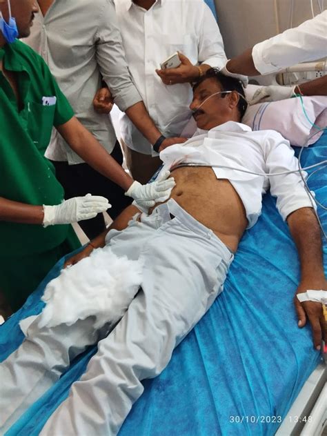 Kotha Prabhakar Reddy పై క‌త్తితో దాడి వీడియో వైరల్