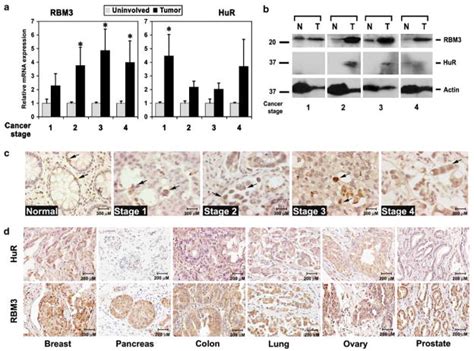 Translation Regulatory Factor Rbm3 Is A Proto Oncogene That Prevents