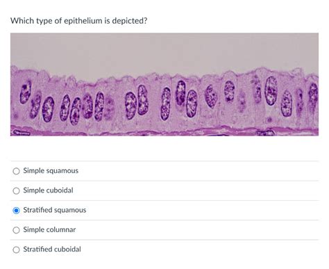 Solved Which Type Of Epithelium Is Depicted Simple Squamous Chegg Com