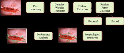 Proposed Flow Of Cervical Cancer Detection System In Testing Mode Download Scientific Diagram